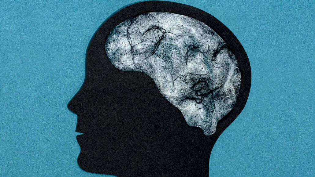 A faulty immune response may be behind lingering brain trouble after ...