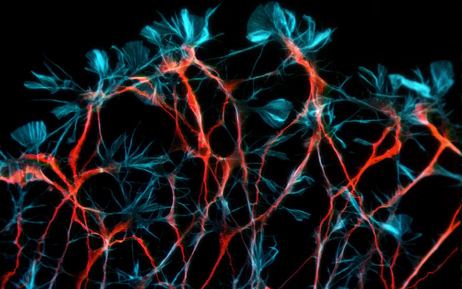Neural Substrates of Body Ownership and Agency during Voluntary ...