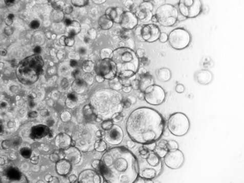 Cancer's origin story features predictable plot line, researchers find ...