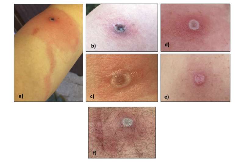 What is Alaskapox? Recent death brings attention to virus seen in small ...