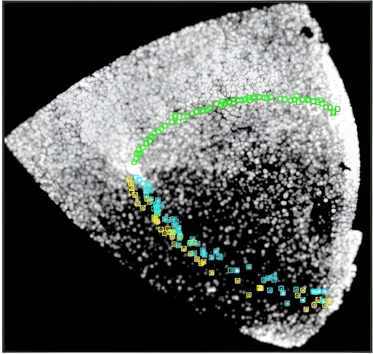 Astronomers detect multiple extended tidal tails in an old globular ...
