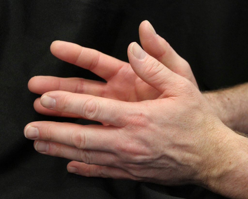 Whats The Difference Between Osteoarthritis And Rheumatoid Arthritis 0431